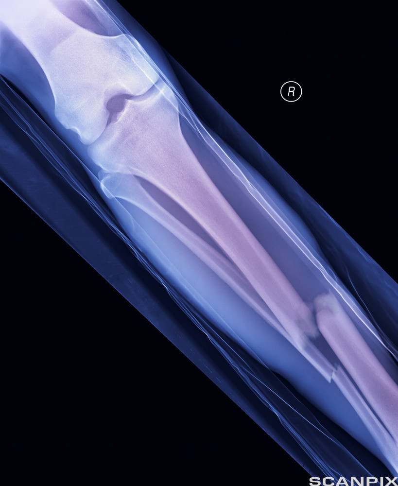 Brudd - Yrkesliv i barne- og ungdomsarbeiderfag (HS-BUA vg2) - NDLA